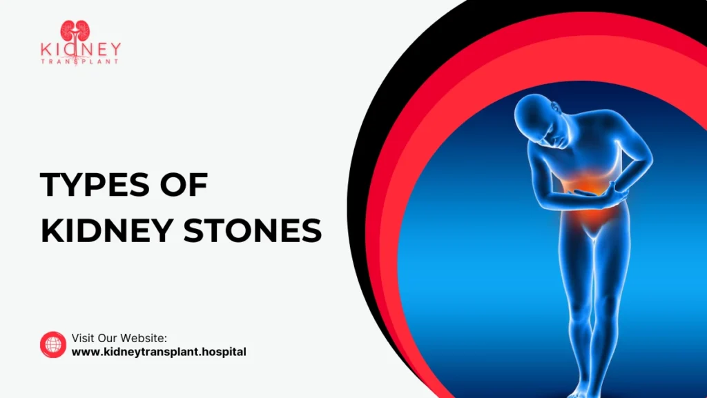 Best 5 Crucial Types of Kidney Stones: Causes & Care